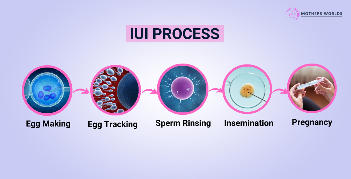 IUI Process - mother